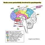 Can you spot a psychopath by looking at their brain? – NW NOGGIN ...