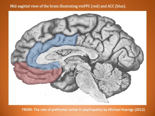 Can you spot a psychopath by looking at their brain? – NW NOGGIN ...