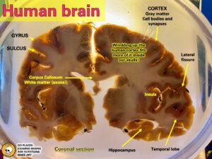 Why are our brains so wrinkly? – NW NOGGIN: Neuroscience outreach group ...